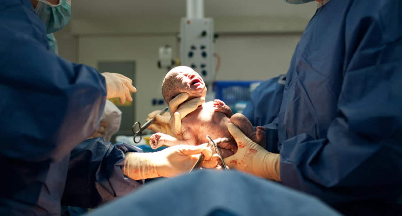 Elective Caesarean Section: What to Expect - Makchic